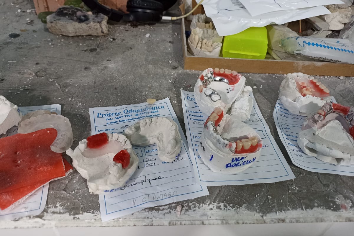 Laboratório interditado: próteses dentárias eram feitas na imundice